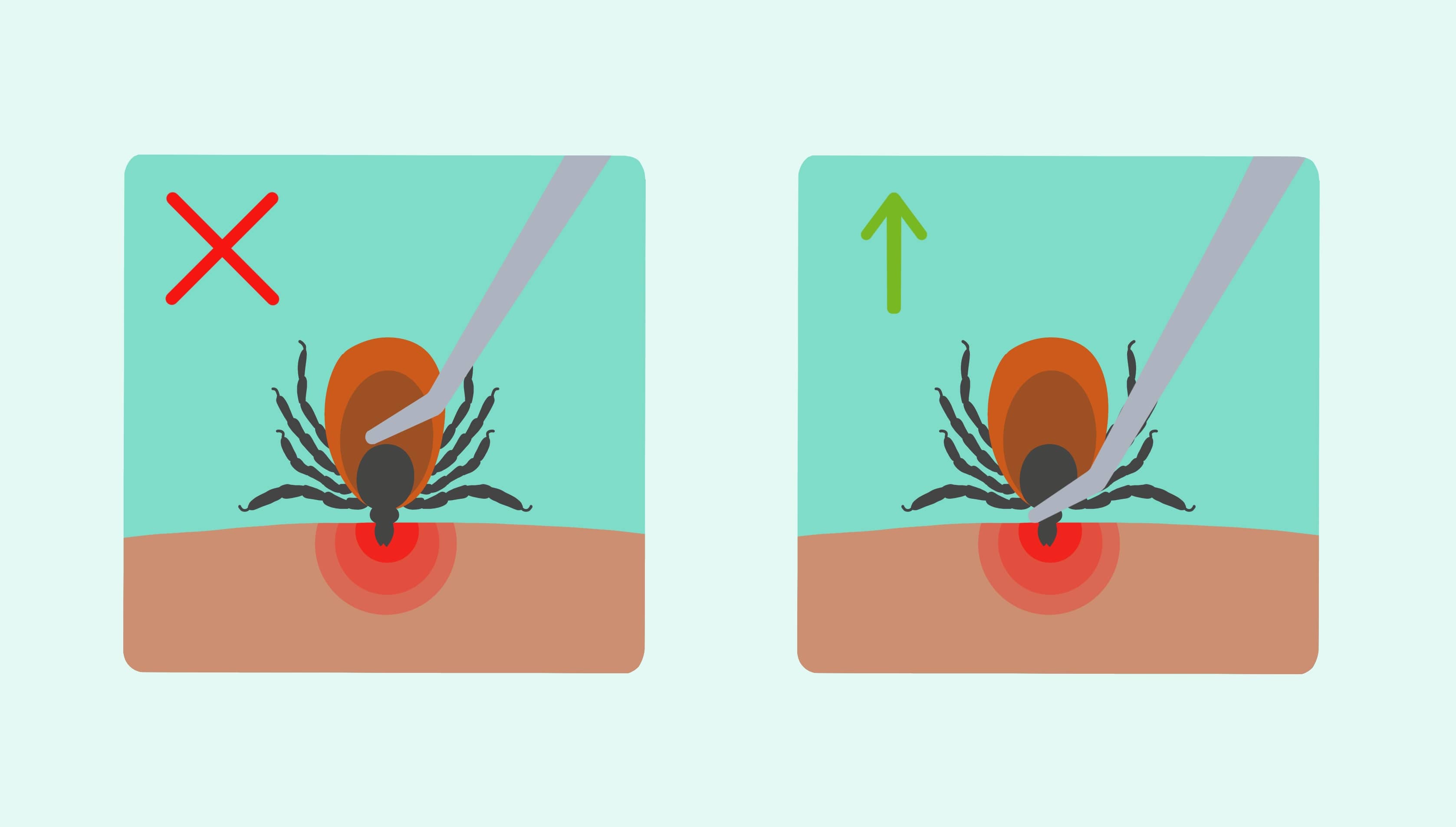 Piqûre de tique : dangers, symptômes et prévention | Redcare Pharmacie